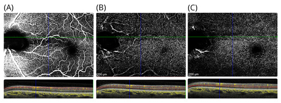 The Role of the Inner Nuclear Layer for Perception of Persisting Tiling ...