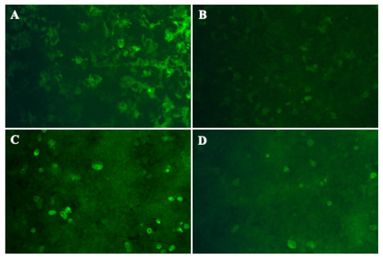 Anti-NF155/NF186 IgG4 Antibody Positive Autoimmune Nodopathy