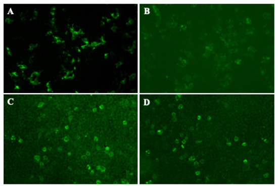 Anti-NF155/NF186 IgG4 Antibody Positive Autoimmune Nodopathy