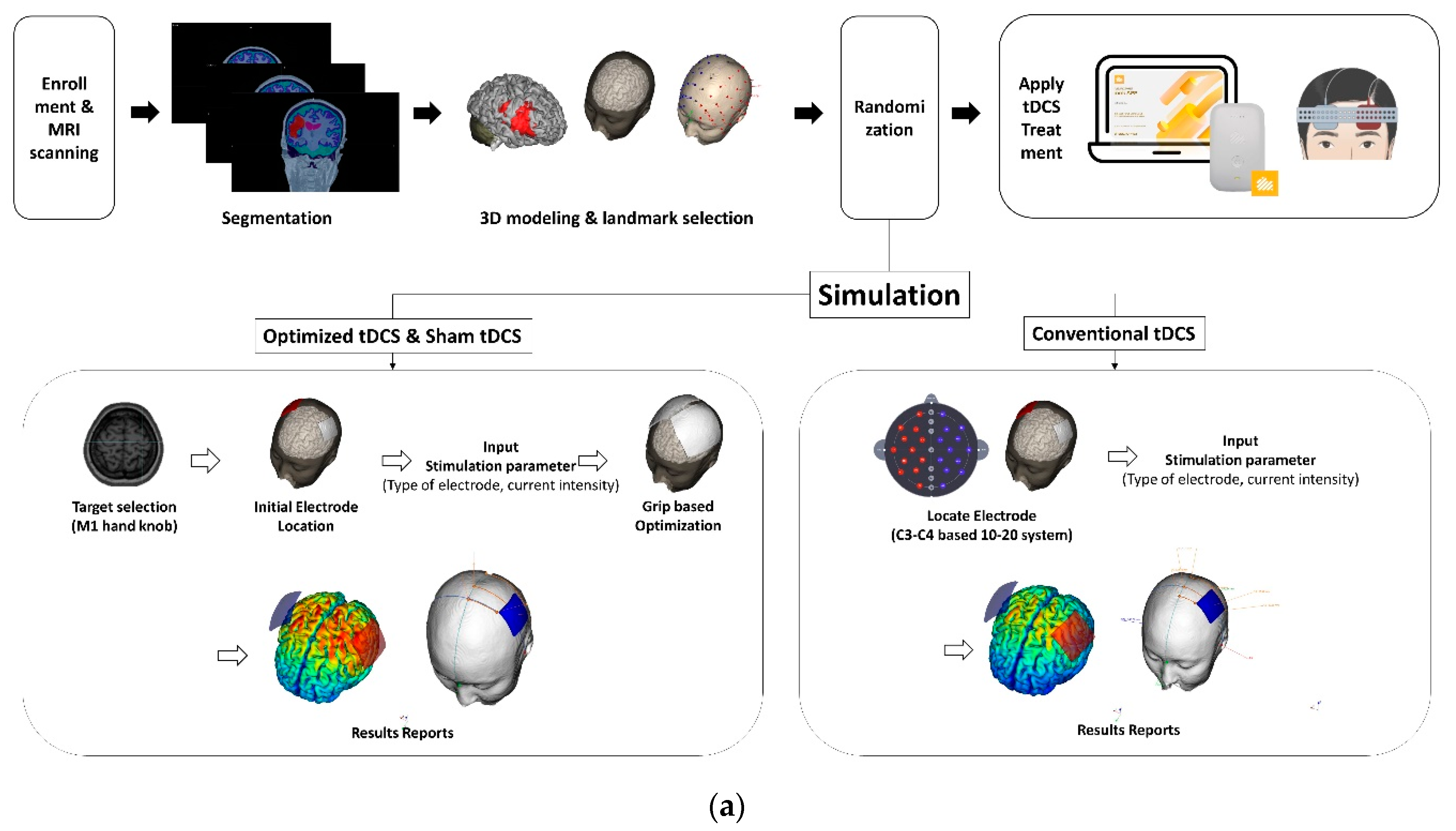 MRI-Based Personalized Transcranial Direct Current Stimulation to ...