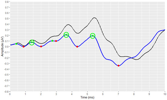 Brain Sciences | Free Full-Text | Development and Evaluation of Automated Tools for Auditory ...