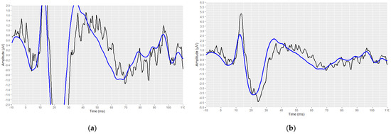 Brain Sciences | Free Full-Text | Development and Evaluation of Automated Tools for Auditory ...