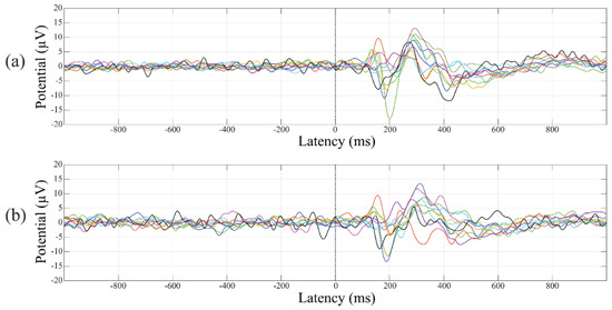 Sleep Deprivation-Induced Changes in Baseline Brain Activity and ...