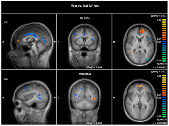 Individual- and Connectivity-Based Real-Time fMRI Neurofeedback to ...