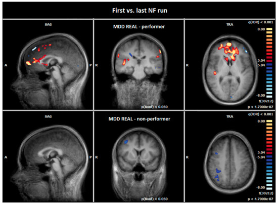 Individual- and Connectivity-Based Real-Time fMRI Neurofeedback to ...