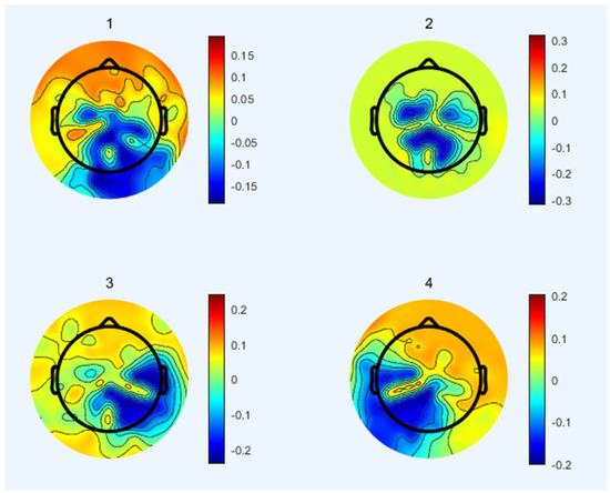 EEG Microstate Features as an Automatic Recognition Model of High-Density Epileptic EEG Using ...
