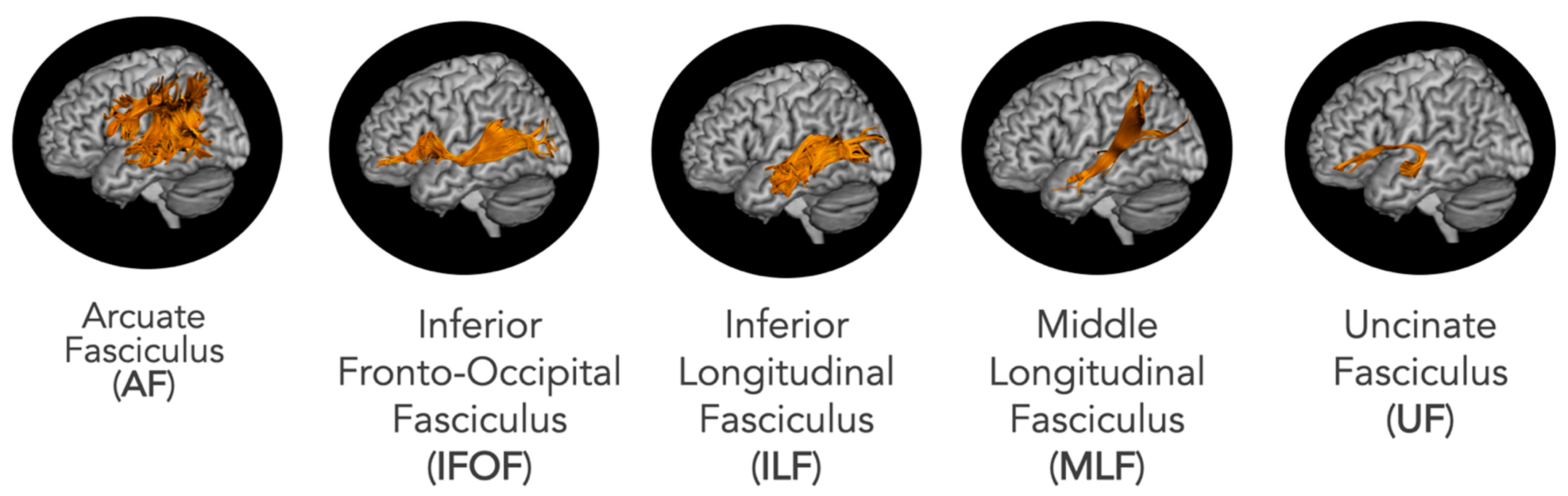 Inferior Longitudinal Fasciculus
