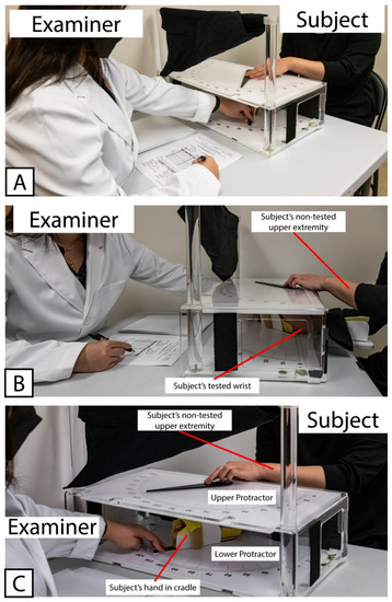 Wrist Proprioception in Adults with and without Subacute Stroke