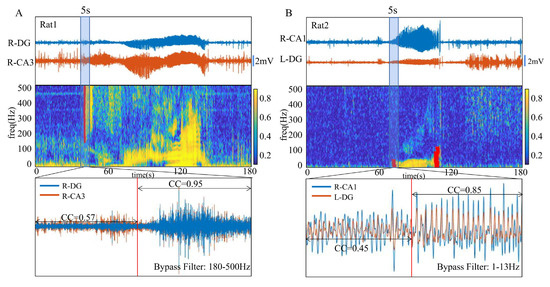 A Feature Extraction Method for Seizure Detection Based on Multi-Site ...