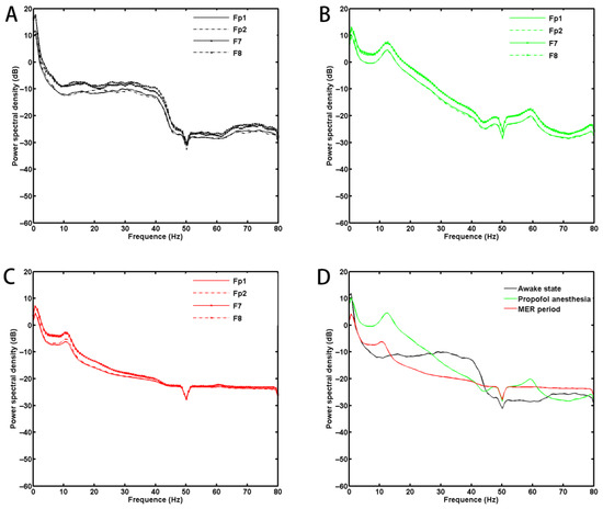 Characteristics of Electroencephalogram in the Prefrontal Cortex during ...