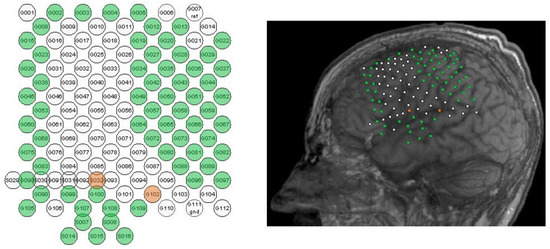 Brain Sciences | Free Full-Text | Application of Soft-Clustering to Assess Consciousness in a ...