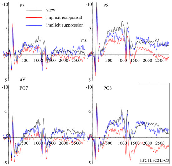 Brain Sciences | Free Full-Text | Estimation Strategy Utilization Is Modulated by Implicit ...