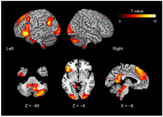 The Role of the Left Inferior Frontal Gyrus in Introspection during ...