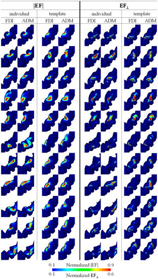 Mapping Brain Motor Functions Using Transcranial Magnetic Stimulation ...
