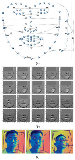Screening Children’s Intellectual Disabilities with Phonetic Features ...