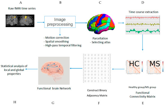 Graph-Based Analysis of Brain Connectivity in Multiple Sclerosis Using Functional MRI: A ...
