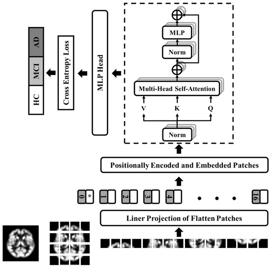 Brain Sciences | Free Full-Text | OViTAD: Optimized Vision Transformer ...