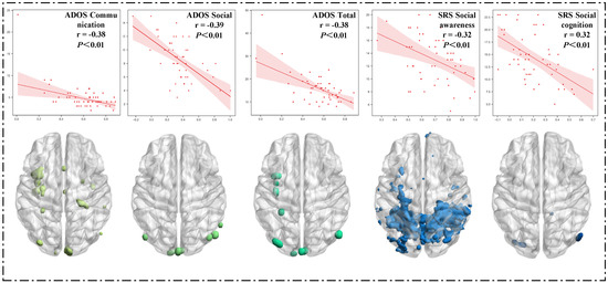 Social Brain Network of Children with Autism Spectrum Disorder ...