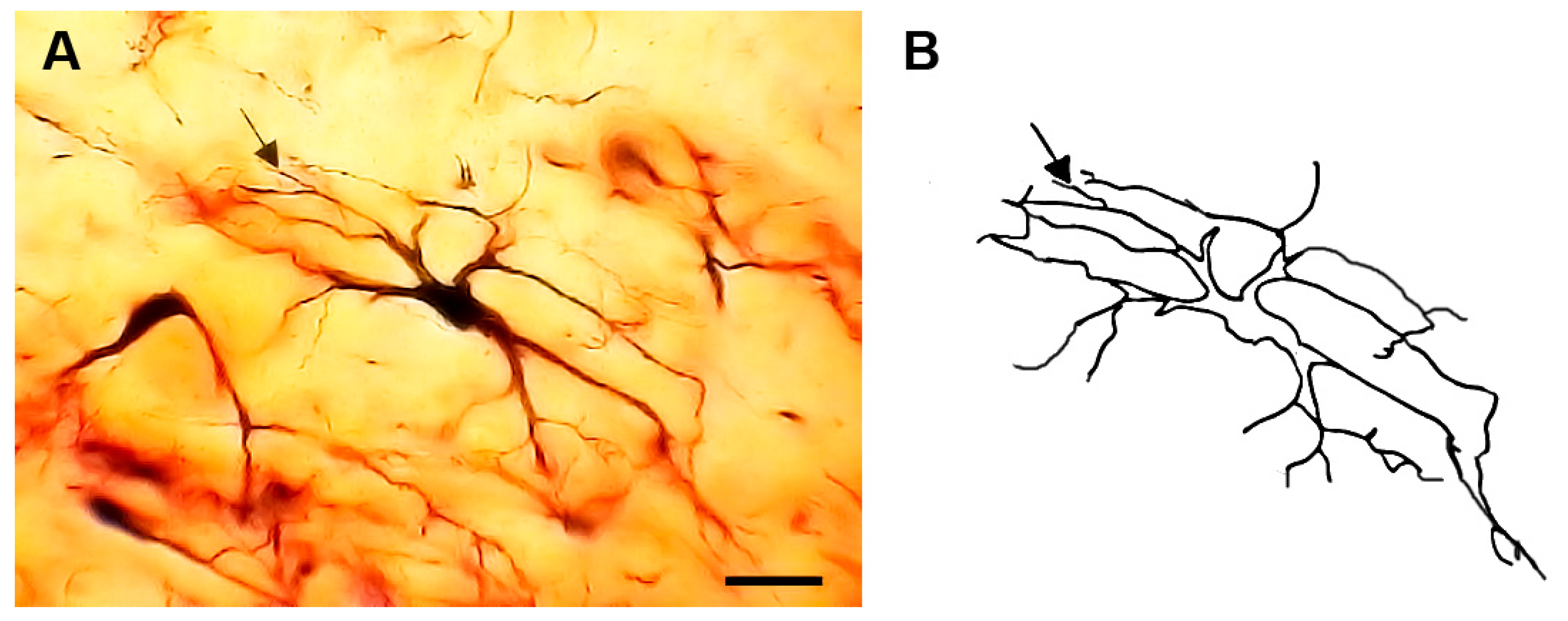 Neuronal Cell Types in the Spinal Trigeminal Nucleus of the Camel Brain