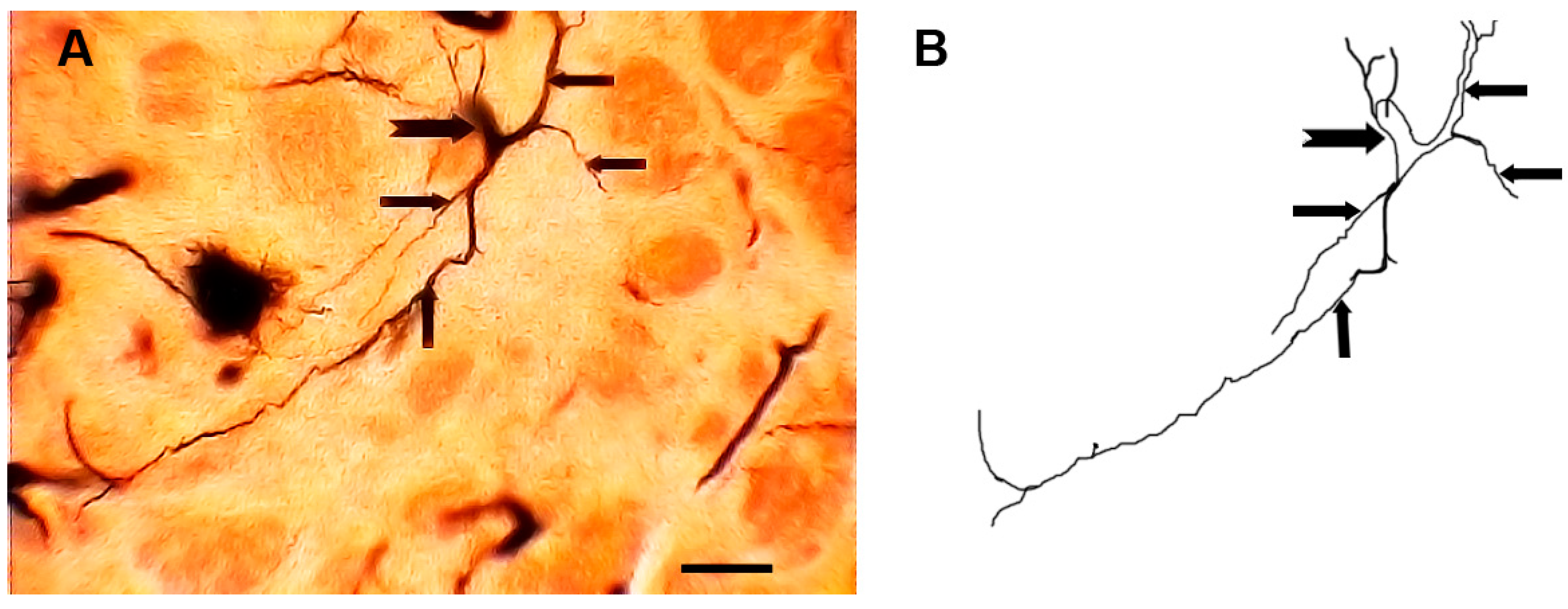 Neuronal Cell Types in the Spinal Trigeminal Nucleus of the Camel Brain