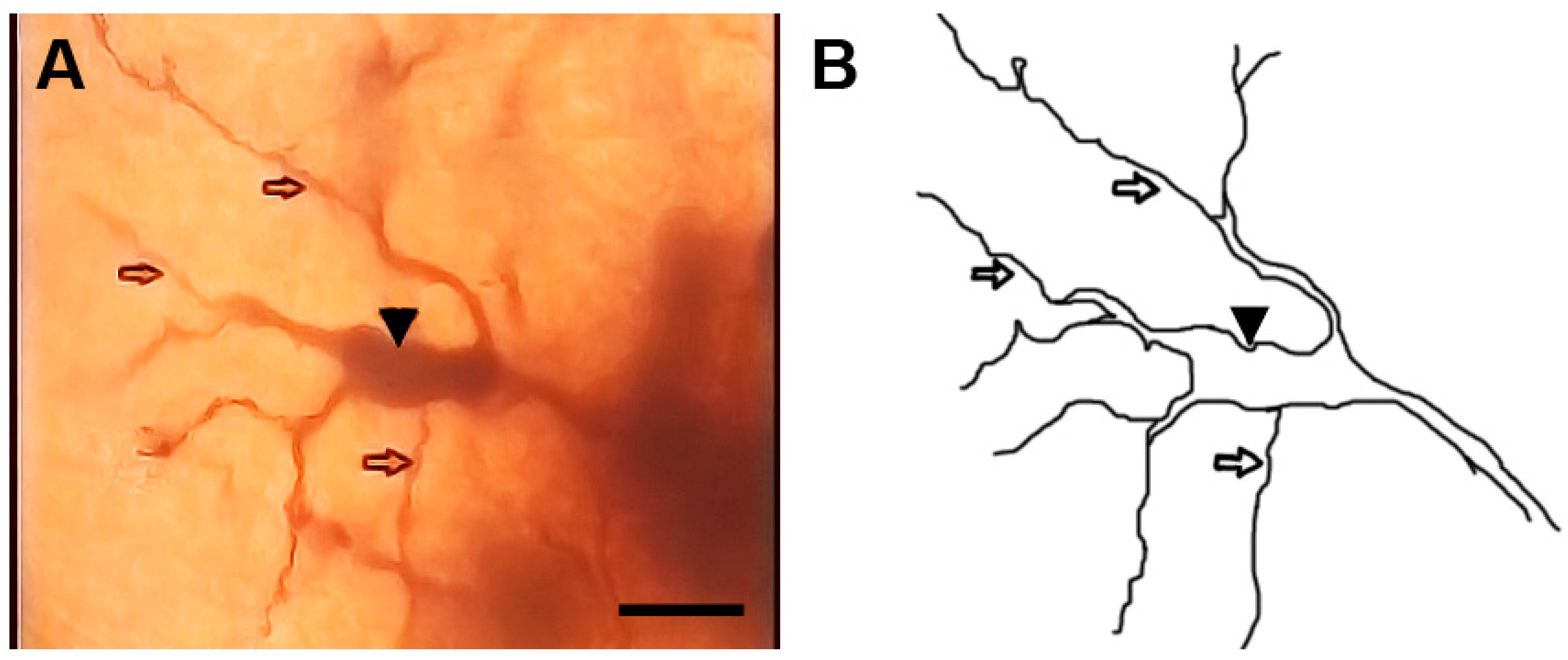Neuronal Cell Types in the Spinal Trigeminal Nucleus of the Camel Brain