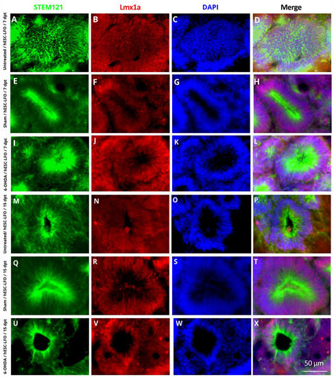 Embryoid Body Cells from Human Embryonic Stem Cells Overexpressing ...
