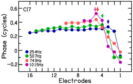 Multi-Frequency Electrocochleography and Electrode Scan to Identify ...