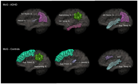 Network-Based Differences in Top–Down Multisensory Integration between ...
