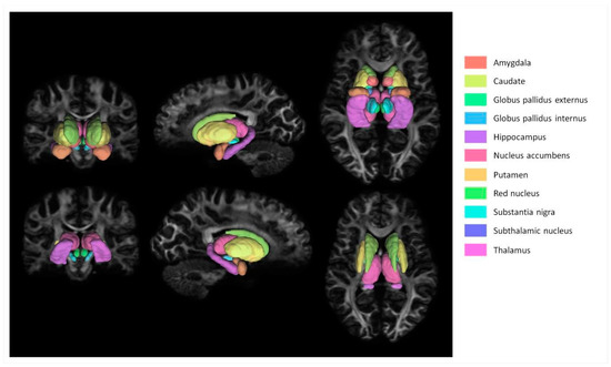 Diffusion Measures of Subcortical Structures Using High-Field MRI