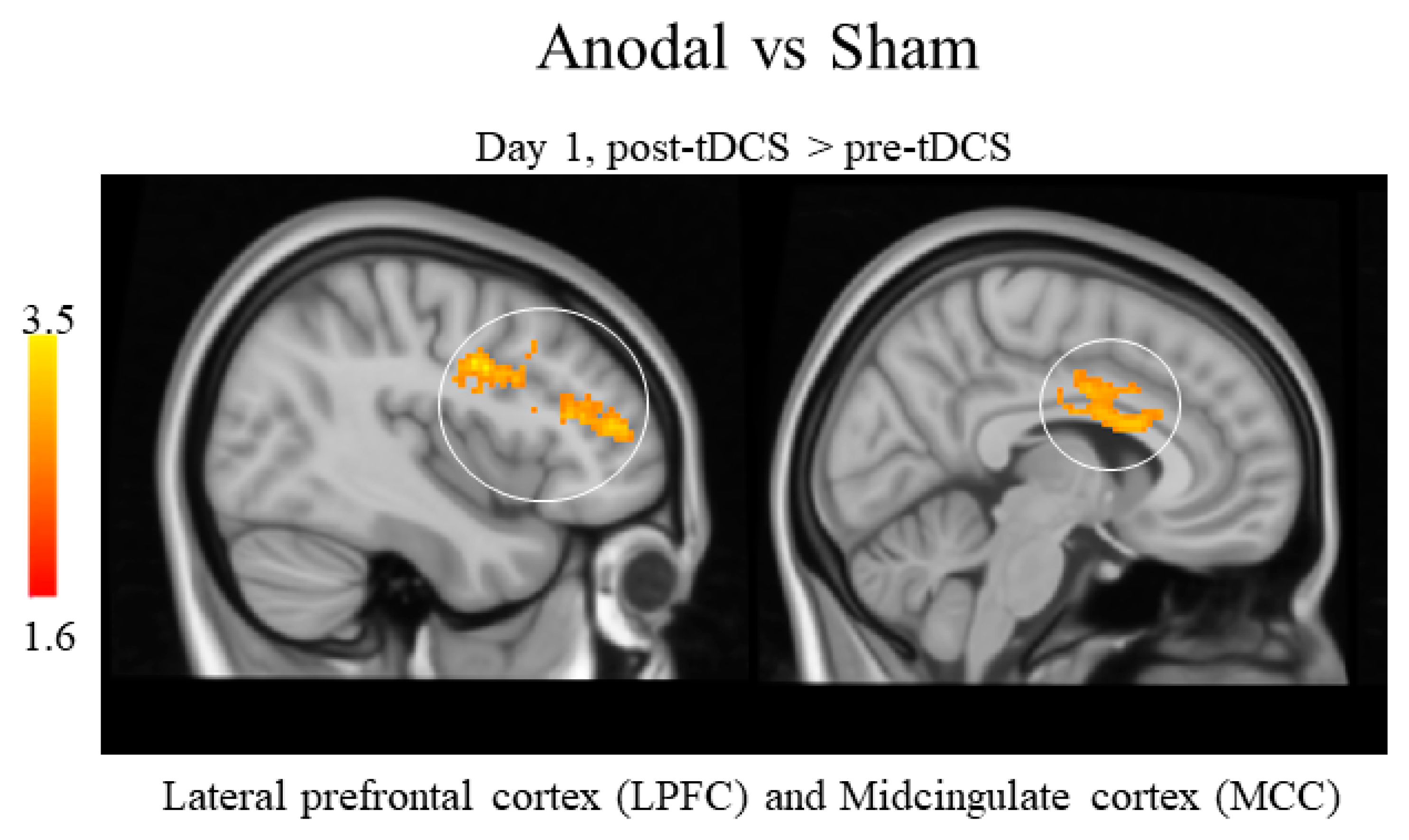 Modulation Effects of Repeated Transcranial Direct Current Stimulation ...