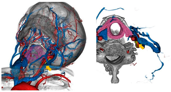 Brain Sciences | Free Full-Text | Vagus Nerve Visualization Using Fused ...