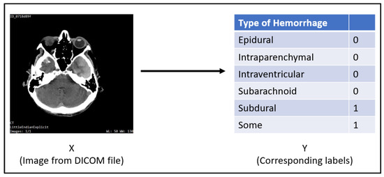 An Efficient Framework to Detect Intracranial Hemorrhage Using Hybrid Deep Neural Networks