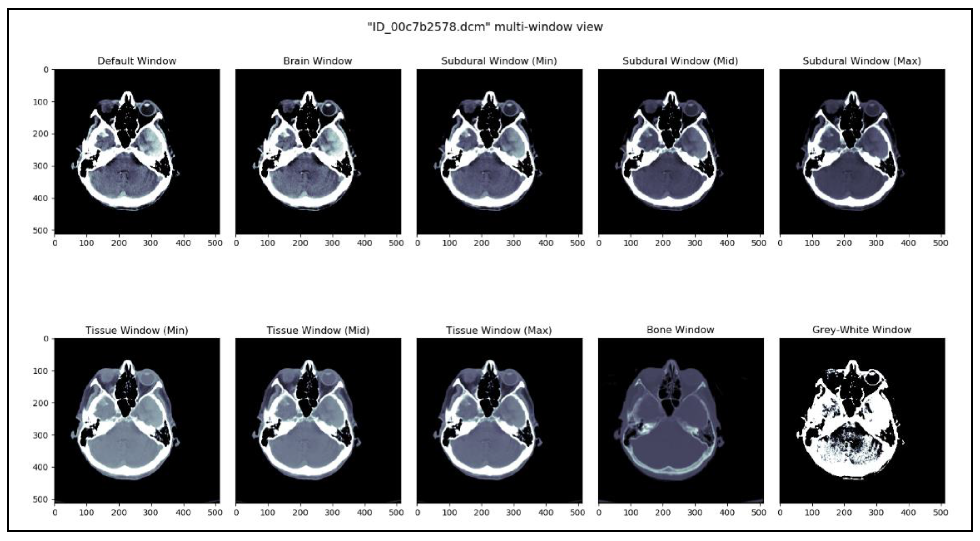 An Efficient Framework to Detect Intracranial Hemorrhage Using Hybrid Deep Neural Networks