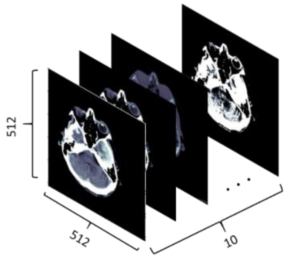 An Efficient Framework to Detect Intracranial Hemorrhage Using Hybrid ...