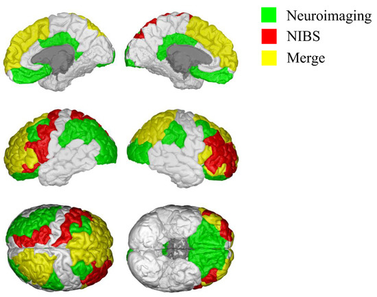 Neural Correlates of Delay Discounting in the Light of Brain Imaging ...