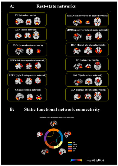 Effects of Combined Intervention of rTMS and Neurotransmitter Drugs on ...