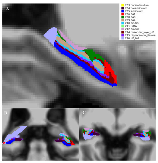 Retinal Alterations as Potential Biomarkers of Structural Brain Changes ...