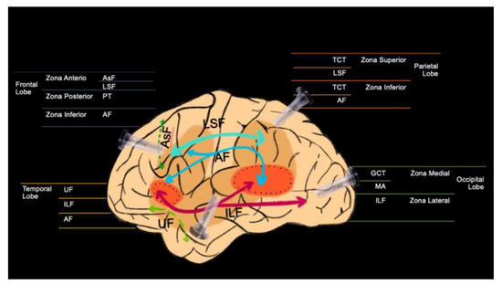 Standardization of Strategies to Perform a Parafascicular Tubular ...