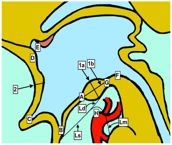Microanatomic Morphometric Characteristics of the Third Ventricle Floor