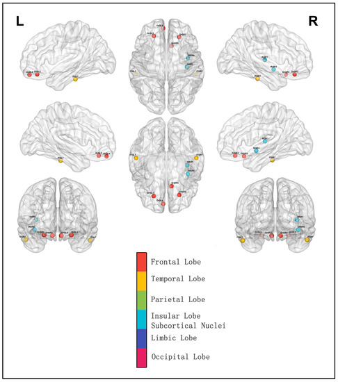 Classification of Migraine Using Static Functional Connectivity Strength and Dynamic Functional ...