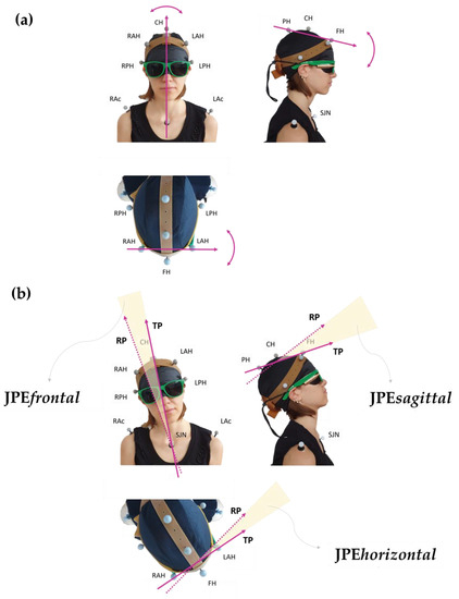 Cervical Proprioception Assessed through Targeted Head Repositioning ...