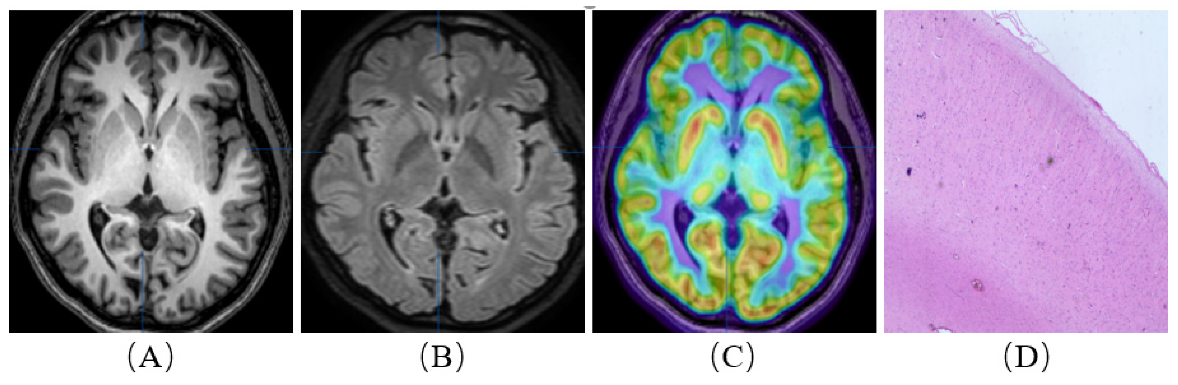 An Assessment of the Pathological Classification and Postoperative ...