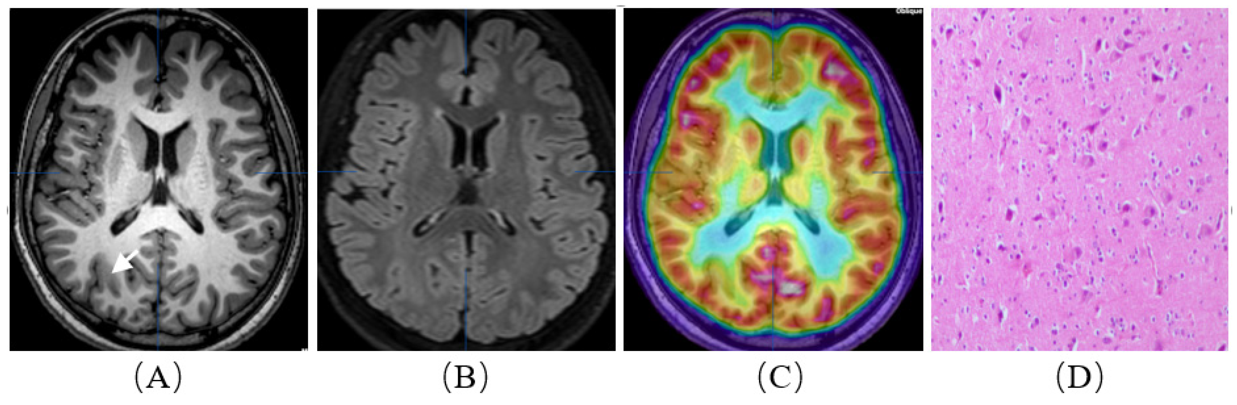 An Assessment of the Pathological Classification and Postoperative ...