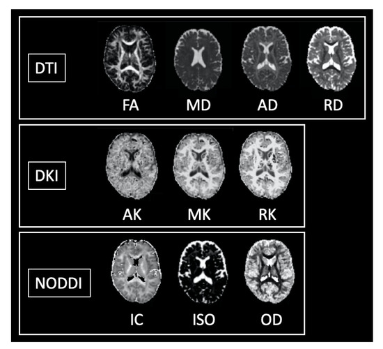 The Value of Various Post-Processing Modalities of Diffusion Weighted ...