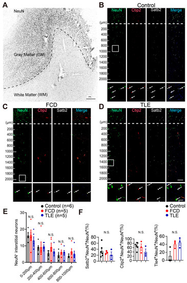 Cortical Layer Markers Expression and Increased Synaptic Density in ...