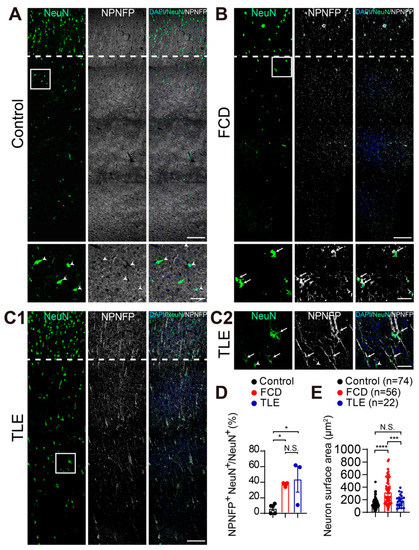 Cortical Layer Markers Expression and Increased Synaptic Density in ...