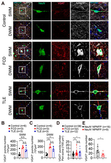 Cortical Layer Markers Expression and Increased Synaptic Density in ...