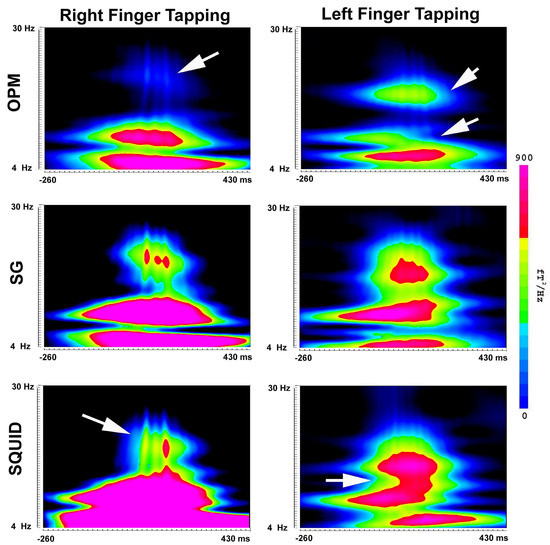 Improved Biomagnetic Signal-To-Noise Ratio and Source Localization ...