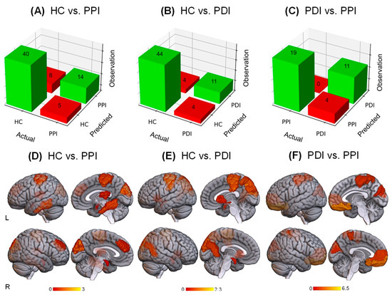 Discriminating Paradoxical and Psychophysiological Insomnia Based on ...