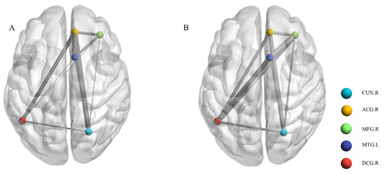 Brain Sciences | Free Full-Text | Altered Resting-State Brain Activity and Functional ...